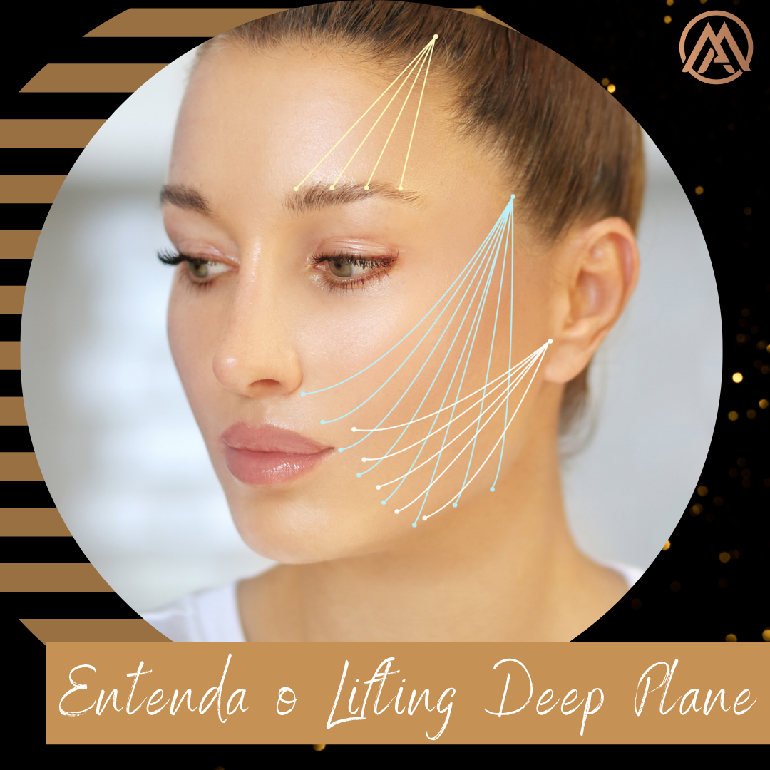 Entenda o Lifting Deep Plane | Dr. André Maschio | Cirurgião Plástico ...